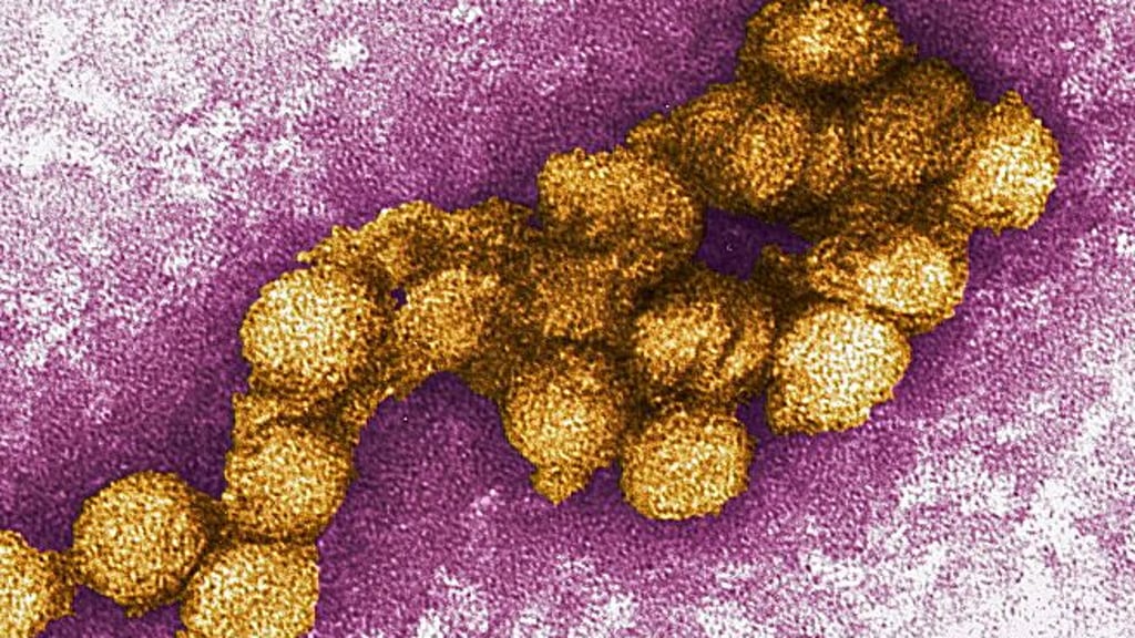 West-Nil-Virus: Erster Fall in der Altmark - Pferd muss eingeschläfert ...