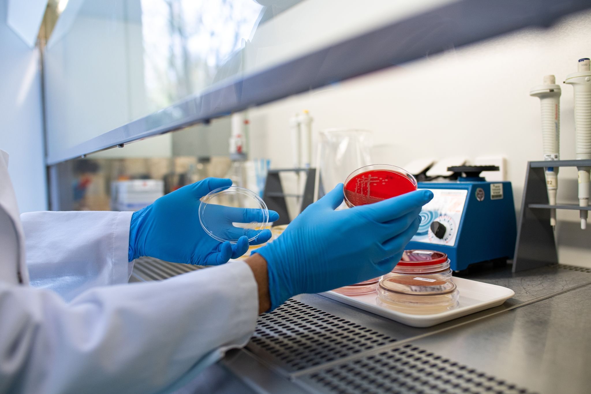 Krankheit: Fünf weitere Ehec-Infektionen in Vorpommern